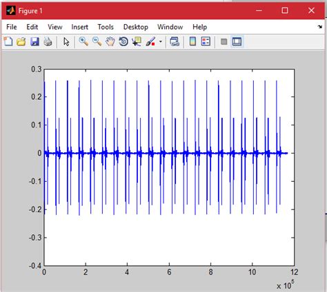 Matlab Heart Beat Analysis Stack Overflow