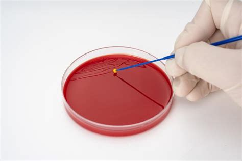 副溶血性弧菌检验 知乎