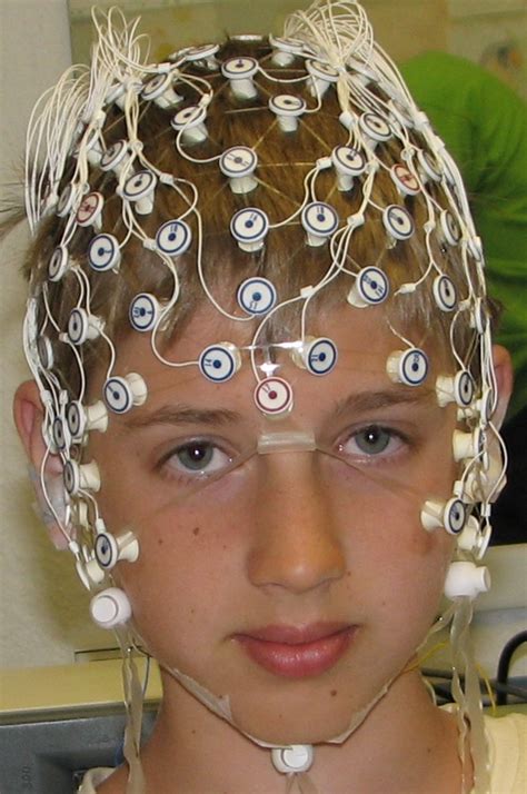 The Photo Shows An 11 Year Old Subject Wearing A High Density Eeg Net