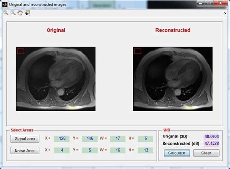 6 Gui Of A Matlab Program Used To Compare The Original And The Download Scientific Diagram