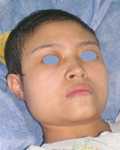 Drguarionex Estrella Semiología Quirúrgica Facies