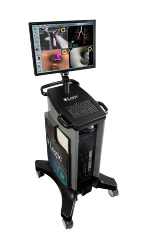 Navigational Gps Bronchoscopy Cardiothoracic Surgery