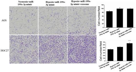 Hypoxic Tumor Derived Exosomal Mir 199a 3p Promote Gastric Cancer