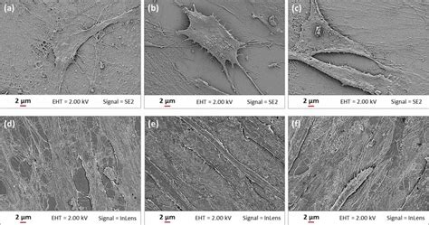 Se And Bse Sem Images Recorded After 7 D Top And 14 D Bottom Of