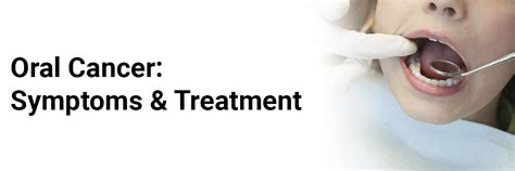 Oral Cancer Symptoms And Treatment