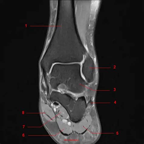 Mri Of The Ankle Detailed Anatomy W Radiology