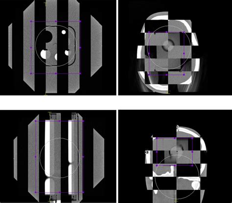 mri ct image registration left column ruby with system qa insert