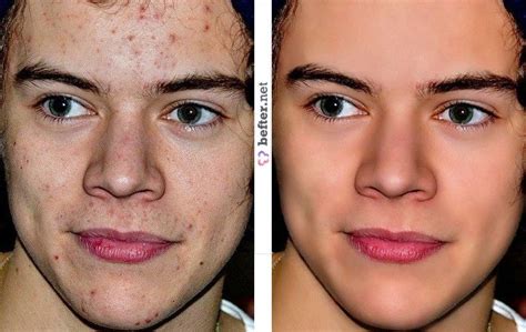 Photoshop Before And After Celebrities
