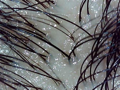 Before After Gallery Revival Scalp Studio