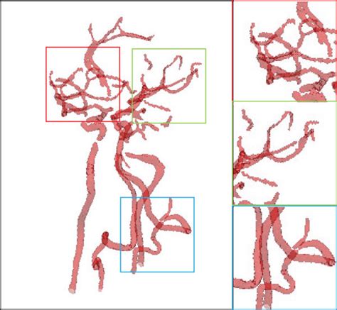Medical Image Segmentation Results Tested In The Dataset Of The Download Scientific Diagram