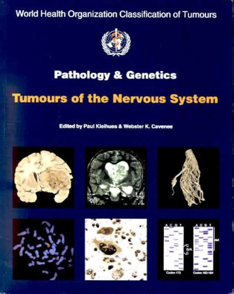 Buy Pathology And Genetics Tumours Of The Nervous System 1ed V 1 Iarc Who Classification Of