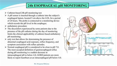 Advanced Diagnostic Strategies In Gerd Pptx