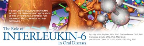 The Role Of Interleukin 6 In Oral Diseases Dimensions Of Dental Hygiene