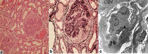 Glomerulus Structure By Light Microcopy And Electron Microscopy Em A Download Scientific