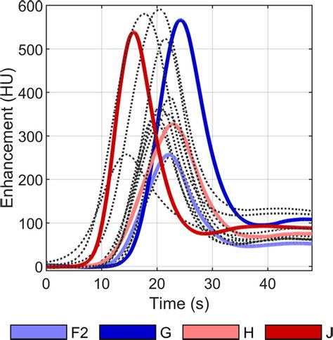 The Average Arterial Input Function Aif Per Stroke Center The Four