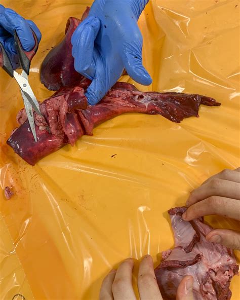 Heart And Lung Dissection