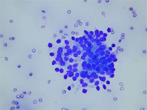 Eurocytology