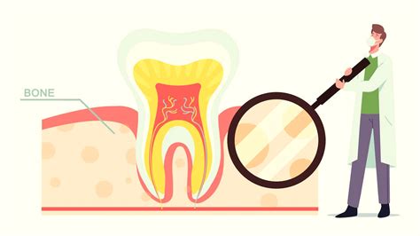 What Is Tooth Root Resorption At Adeline Ouellette Blog
