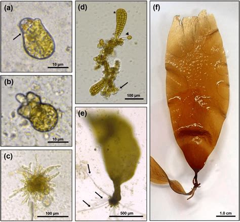 Indirect Development Of Protoplasts Derived From Undaria Pinnatifida