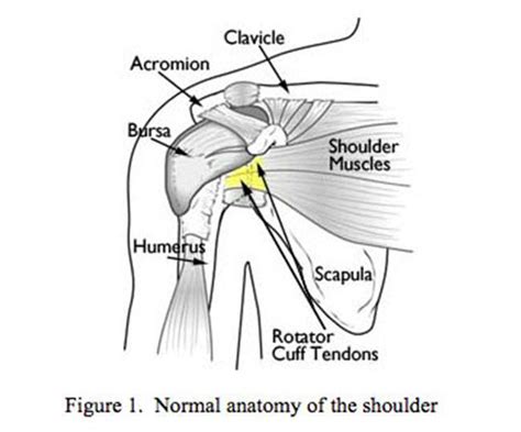 Shoulder Impingement Syndrome Wikipedia 47 Off