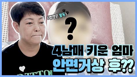 [별성형외과] 50대 엄마의 안면거상술‼ 4남매 키우신 우리엄마 심술보 불독살 없앨 수 있을까요 모델 신청 완료💌 Youtube