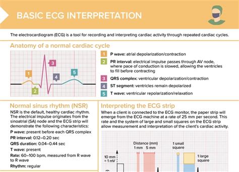 Basic Ekg Interpretation Nurse Sarah Ekg Ecg Interpretation By Nurse
