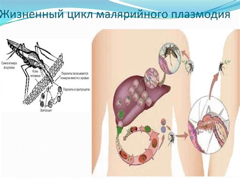 Малярия Возбудитель малярии презентация онлайн