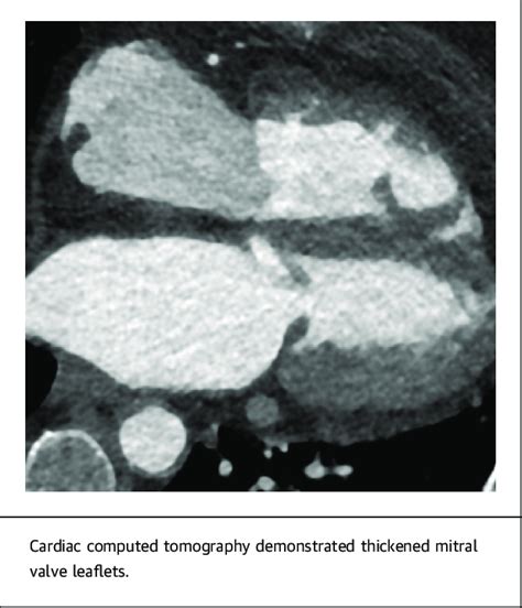 Cardiac Computed Tomography Download Scientific Diagram
