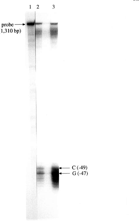 Figure 2 From Cloning Characterization And Functional Analysis Of Ubc 2 A Gene Encoding A