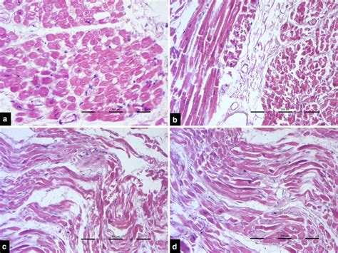 A Typical Cardiac Myocytes Of The Atrial Muscle Sleeves With Central