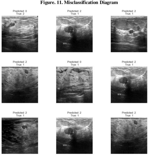 Figure 4 From Enhanced Breast Cancer Tumor Classification Using Mobilenetv2 A Detailed