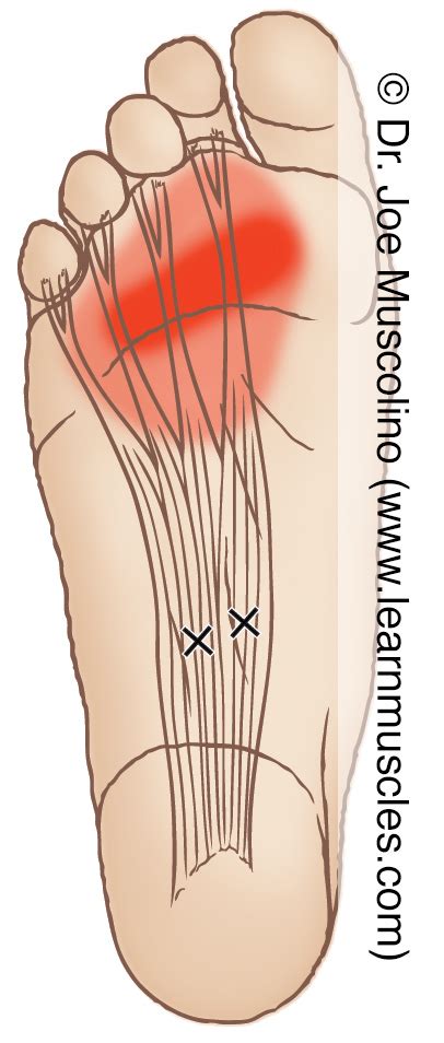 Flexor Digitorum Brevis Trigger Points Learn Muscles