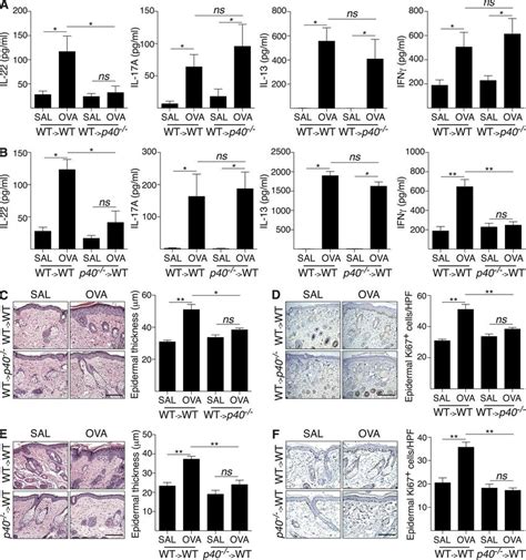 Il 23 Derived From Both Nonhematopoietic And Hematopoietic Cells Is