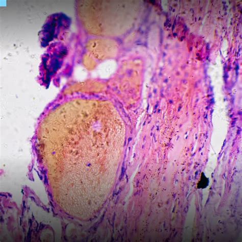 Jayita Bhattacharyya On Linkedin Technology To Enhance Treatment 13