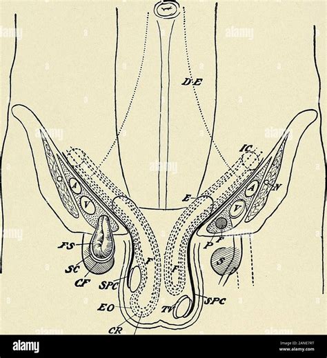 Inguinal Hernia Anatomy Indirect