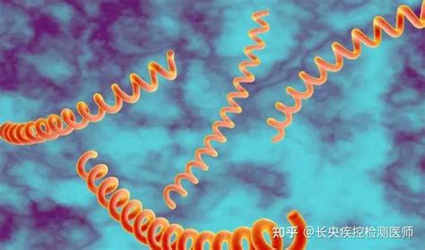 11天梅毒感染能查出来吗最早都是多少天查出来的？ 知乎