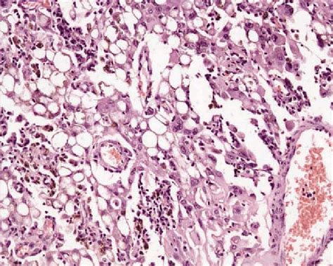 Reticular Pattern Of Growth Download Scientific Diagram