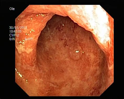 Simulamet Hostkvasir Vqa · Datasets At Hugging Face