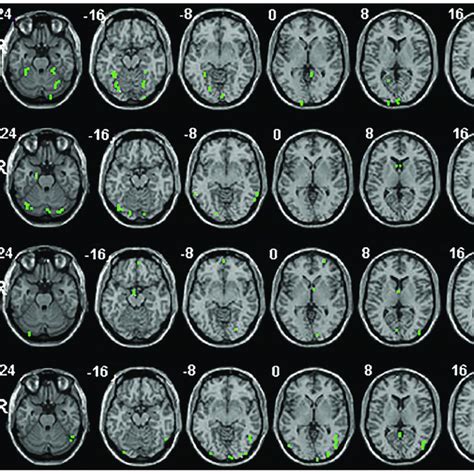 The Voxel Pattern Relevant To Each Task Of Splsr For One Subjects Real