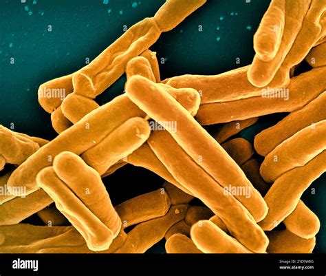 Scanning Electron Micrograph Of Mycobacterium Tuberculosis Particles Colorized Gold The