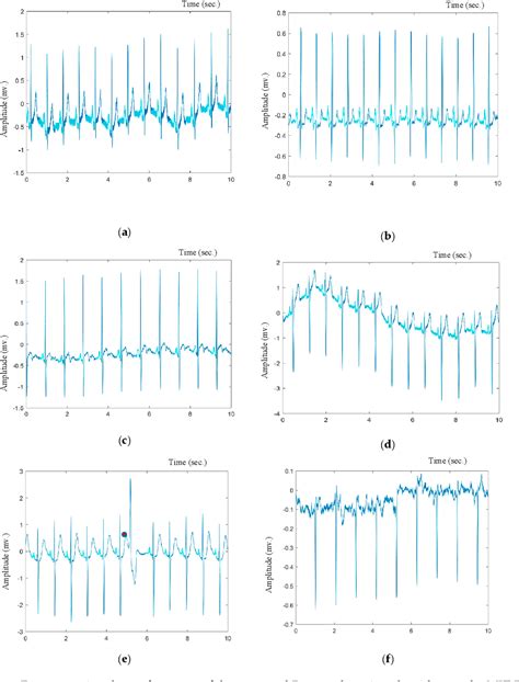 figure 5 from p wave detection using a fully convolutional neural