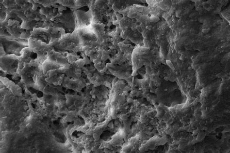 Sem Showinglaser Etched Enamel Surface 1w2000x Download Scientific