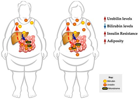 Bilirubin Levels Are Negatively Correlated With Adiposity In Obese Men And Women And Its