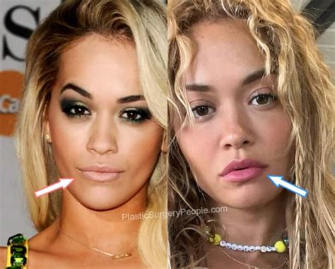 Rita Ora Before And After 2022