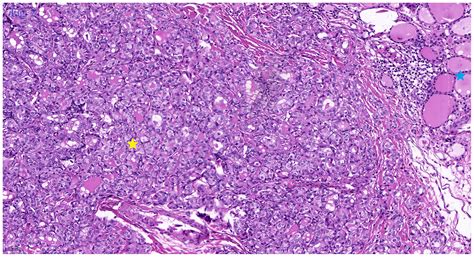 Clinical Characteristics And Survival Outcomes In Patients With Primary