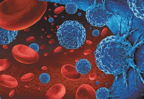 Leukemia And Lymphoma Awareness Month Shining A Light On Hope And