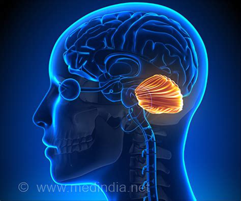 Spinocerebellar Ataxia Types Causes Symptoms Diagnosis 45 Off