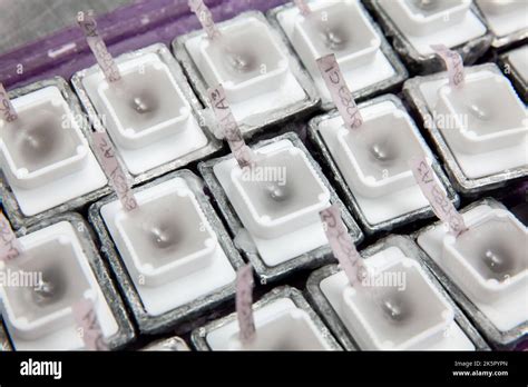 Embedded Tissues In Paraffin Blocks For Sectioning Pathology Laboratory Cancer Diagnosis Stock