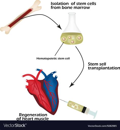 Stem Cells From Bone Marrow Is Used To Regenerate Vector Image