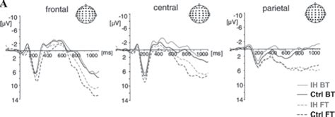 Temporal Dynamics Of Interlingual Reformulation